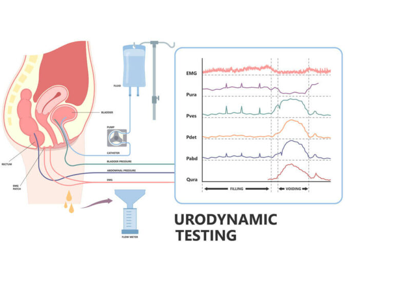 Leistungsspektrum - Praxis für Urologie in Heidelberg